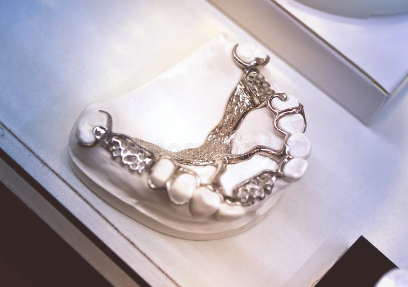 Example of a Bridge on an Artificial Human Jaw Stock Photo - Image of ...