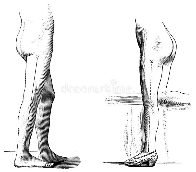 Examples of the Position of the Feet of a Person with and without Shoes ...