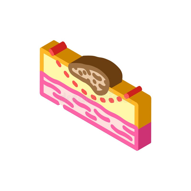 Excisional Biopsy Surgery Isometric Icon Vector Illustration Stock ...