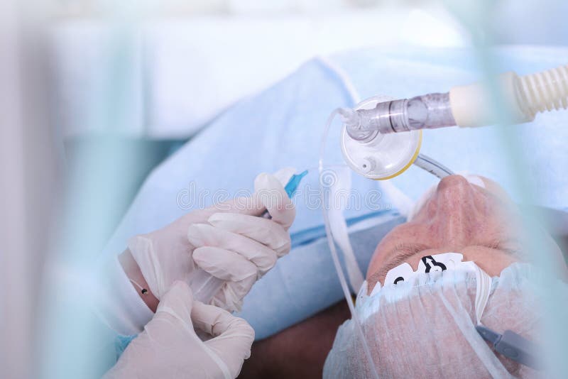 Introduction To General Anesthesia before Surgery. Close-up. Breathing ...