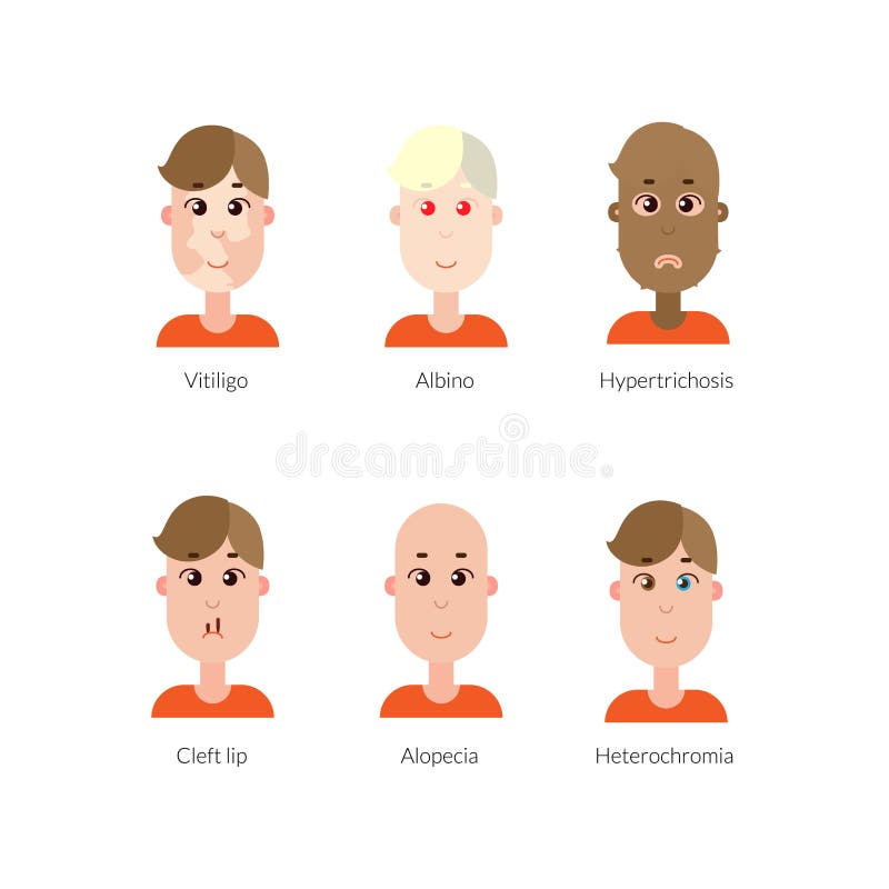 Cleft Lip Stock Illustrations – 19 Cleft Lip Stock Illustrations ...