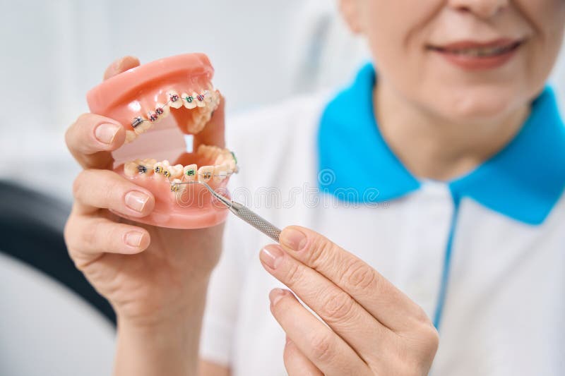 Experienced Orthodontist Pointing at Tooth in Wrong Position Stock ...