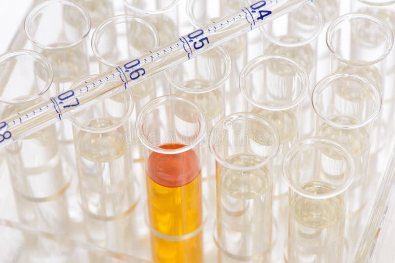 Experiment in Chemical Lab with Liquid in Test Tube Stock Photo - Image ...