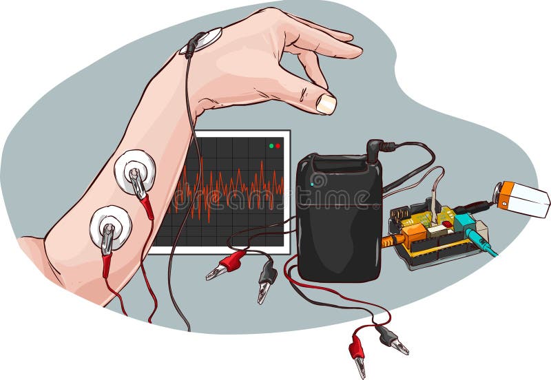 Emg Stock Illustrations – 26 Emg Stock Illustrations, Vectors & Clipart ...