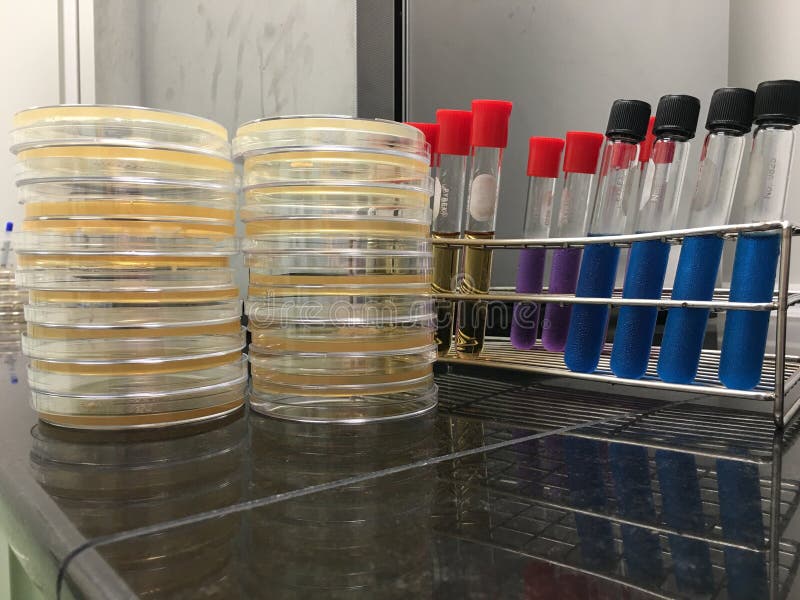 Laboratory Glassware Plate and Chemical Solution Background Image Stock ...