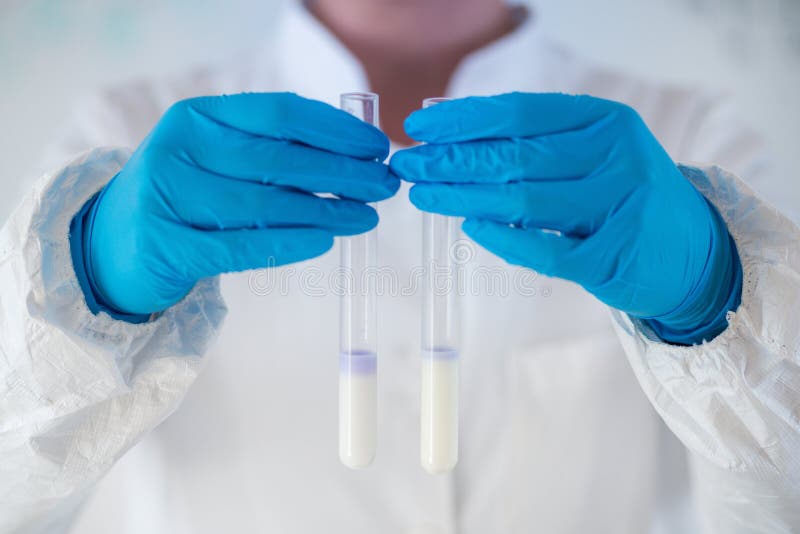 An Expert Assesses Milk Quality in a Laboratory, Using Test Tubes for ...