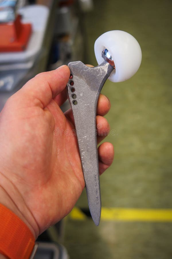 A Explanted Hip Prosthesis Was Cleaned after Surgery Stock Image ...