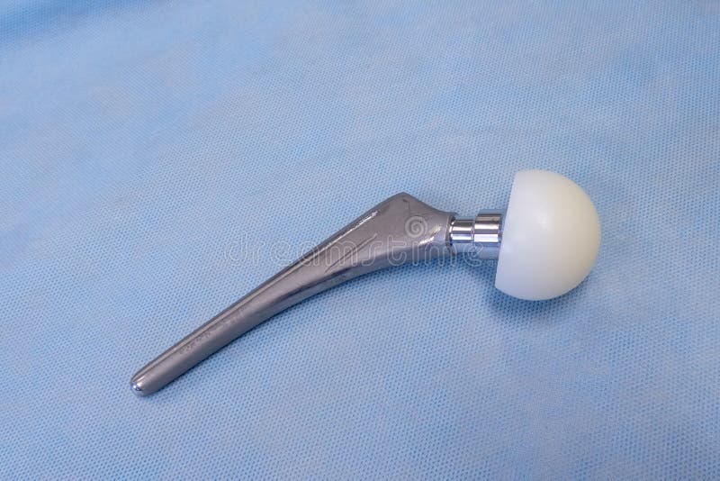 An Explanted Surgical Hip Prosthesis Lies on an Operating Table Stock ...