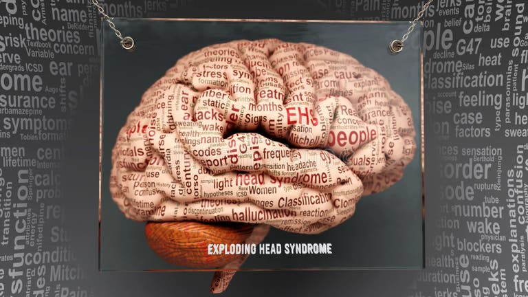 Exploding Head Syndrome in Human Brain Stock Illustration ...