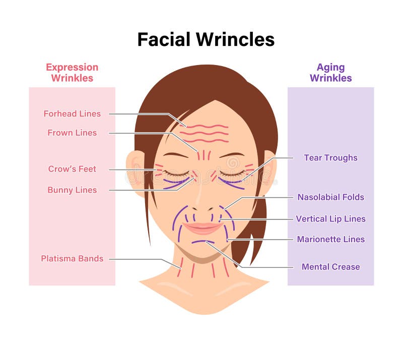 Expression Wrinkles and Aging Wrinkles ( Female Face ) Vector ...