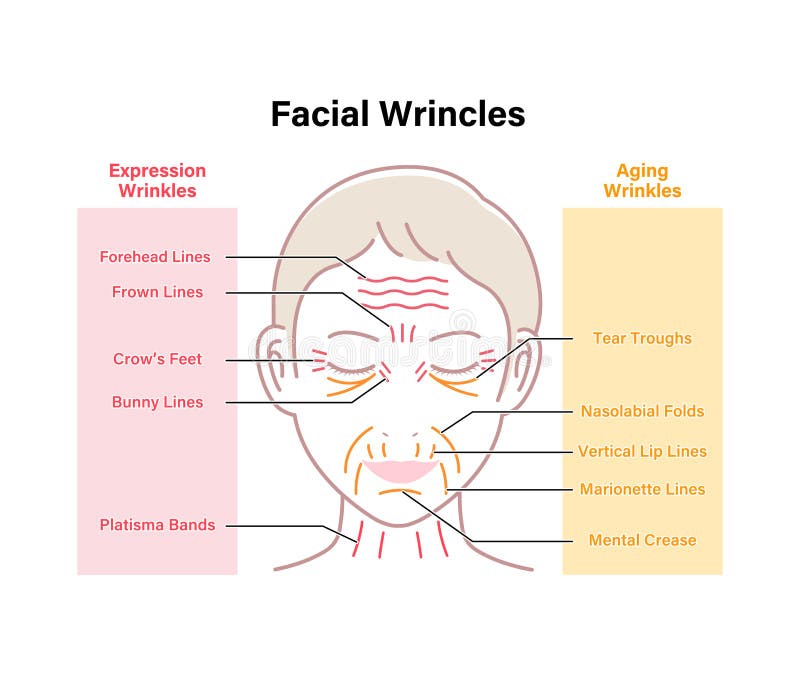 Expression Wrinkles and Aging Wrinkles Female Face Vector Illustration ...