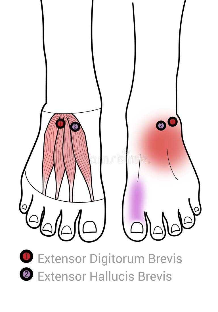 Extensor Hallucis Brevis Extensor Digitorum Brevis Stock Illustrations ...
