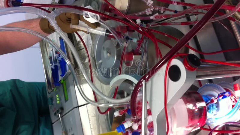 Cardiac Surgery Stock Footage & Videos - 501 Stock Videos