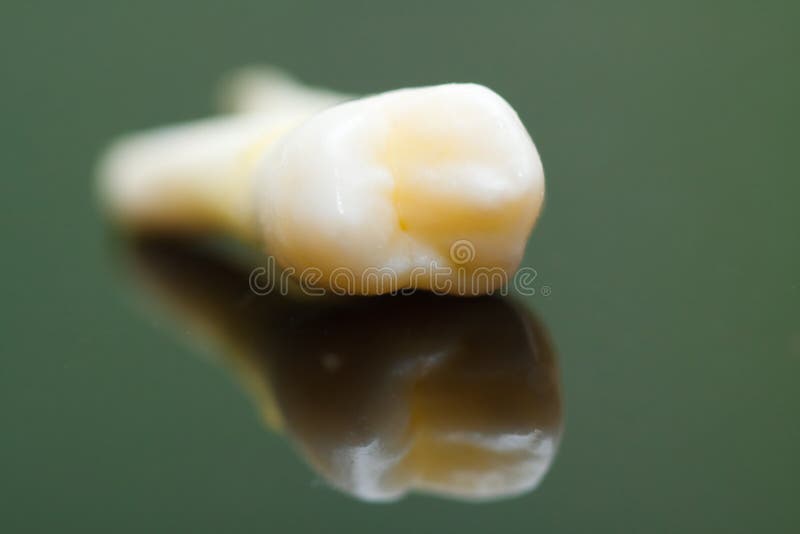 Extracted Tooth with Strange, Curved Root Stock Photo - Image of white ...