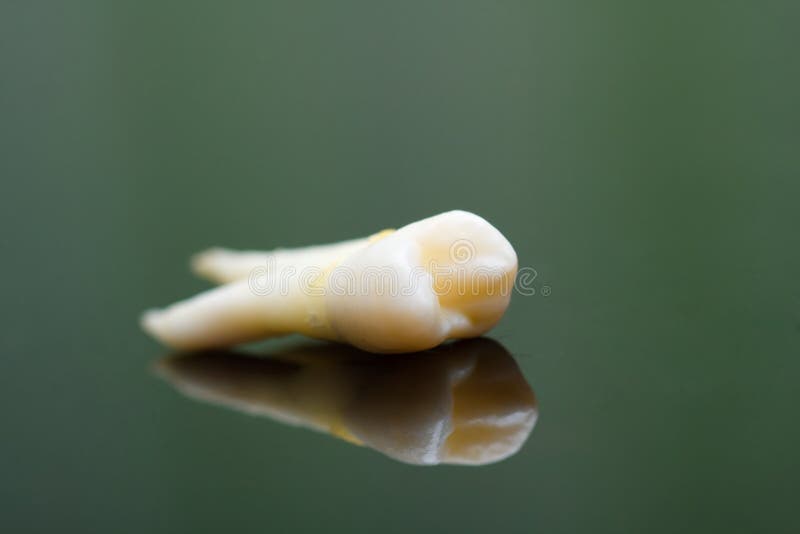 Extracted tooth stock photo. Image of white, tooth, extracted - 18187638