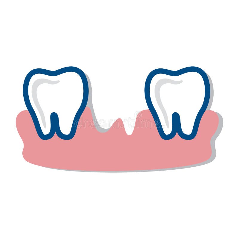 Extracted Tooth. Vector Illustration Decorative Design Stock Vector ...