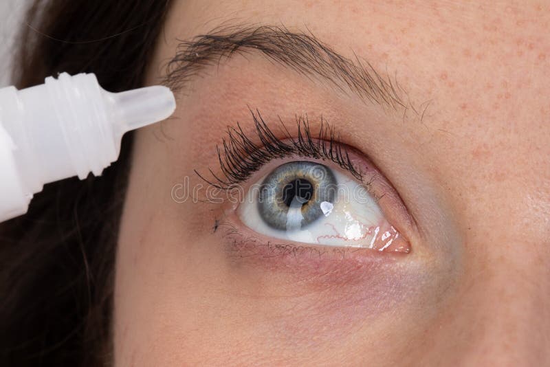 Extreme Close Up of Beautiful Blue Eye Being Treated with Eyewash ...