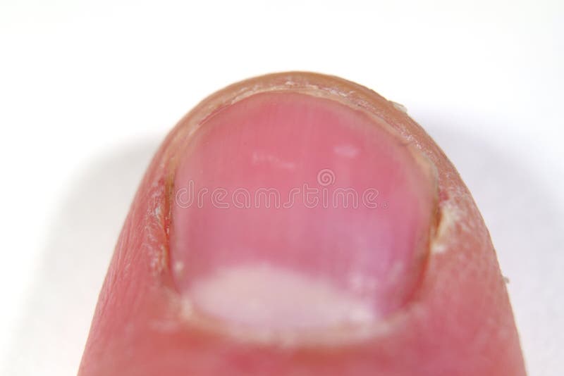 Extreme Closeup of Finger Tip Stock Photo - Image of nail, valleys ...