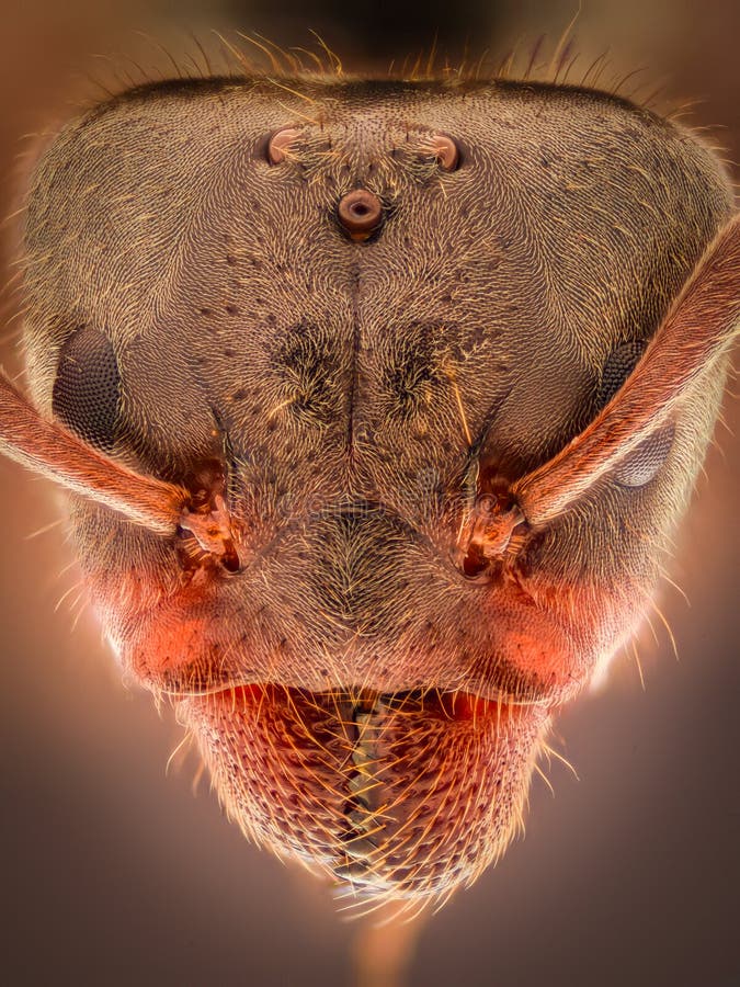 Pimple Extreme Macro stock image. Image of hair, bump - 23621239