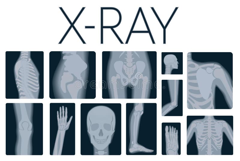 Extreme Quality Realistic Vector Collage Set of Many X-rays Shots. X ...