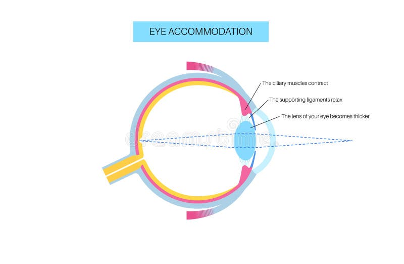 Eye accommodation poster stock vector. Illustration of accommodation ...
