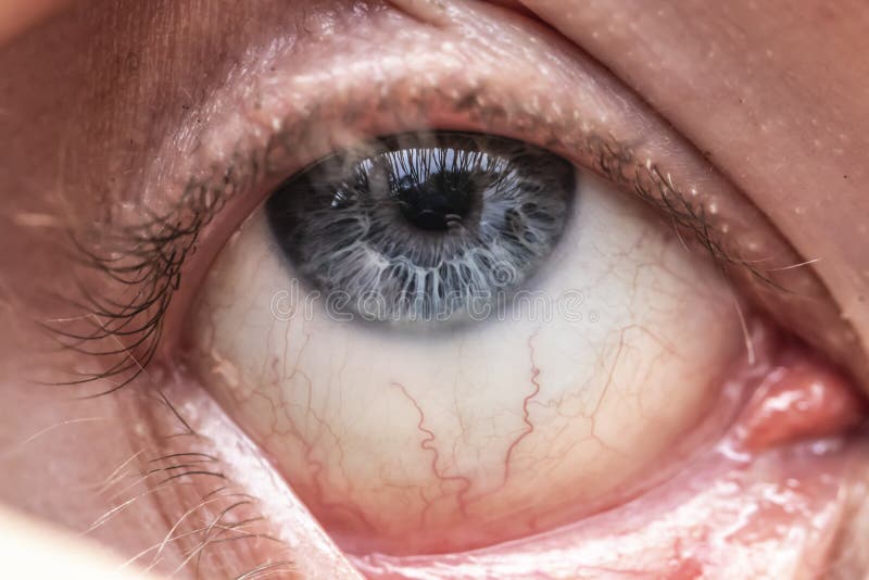 An Eye Ball Open Close Up stock image. Image of open - 120376937