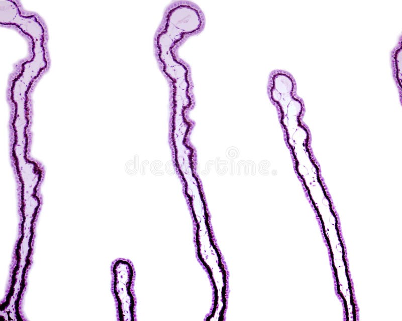 Eye. Ciliary body stock image. Image of histological - 303600595