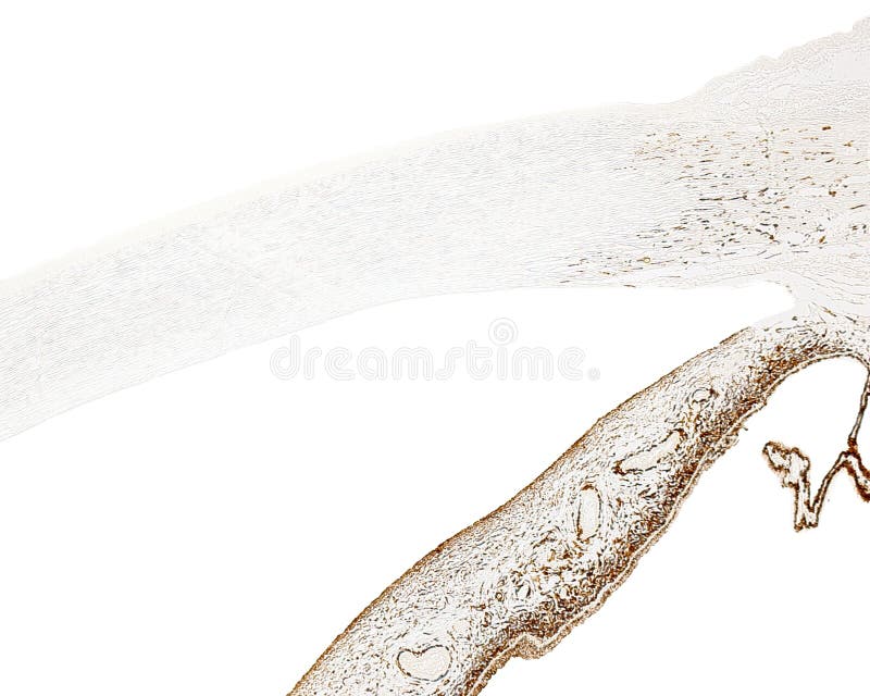 Eye. Iris and ciliary body stock photo. Image of ophthalmology - 303600082