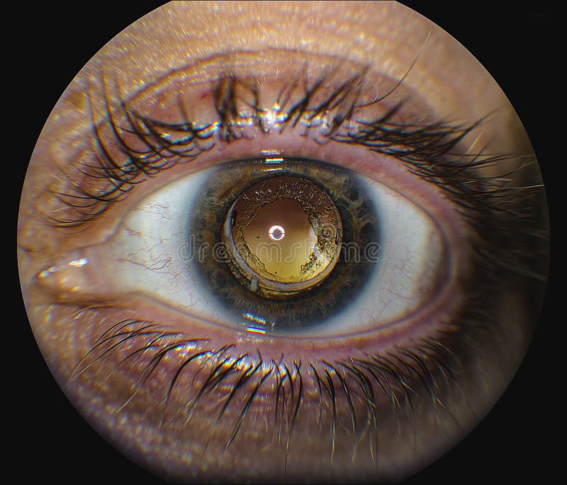 Eye Delated Stock Photos - Free & Royalty-Free Stock Photos from Dreamstime