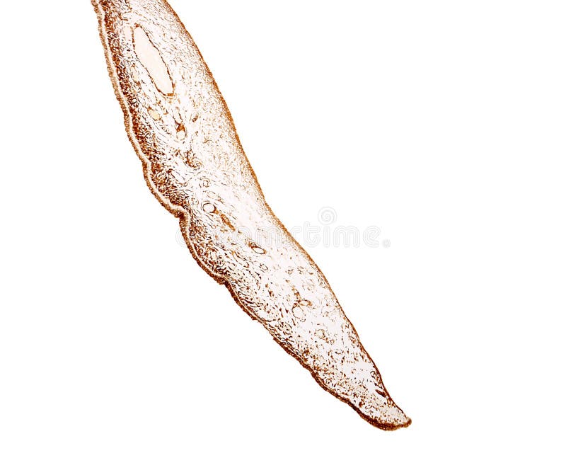 Eye. Iris Pigment. Unstained Section Stock Image - Image of microscope ...