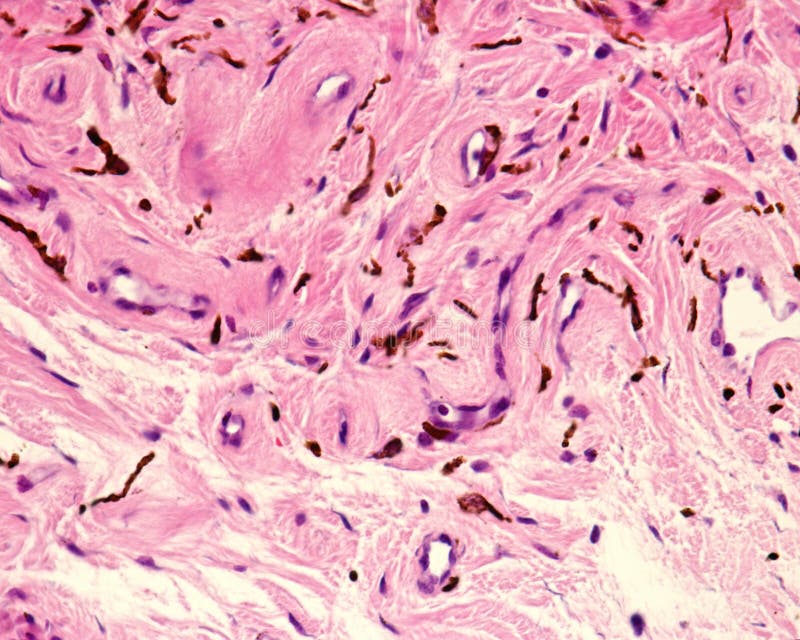 Eye. Iris stroma stock photo. Image of pigment, microscope - 303600138