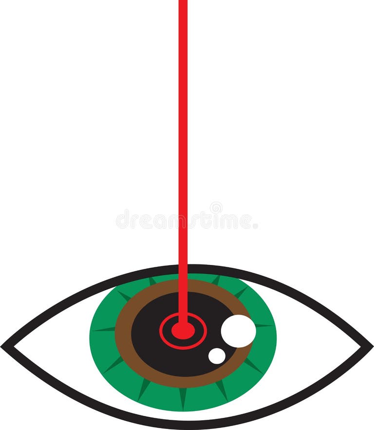 Lasik Laser Stock Illustrations – 448 Lasik Laser Stock Illustrations ...
