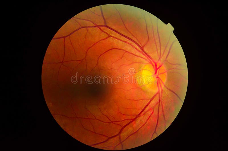 The eye of the microscope stock image. Image of clinic - 85254681