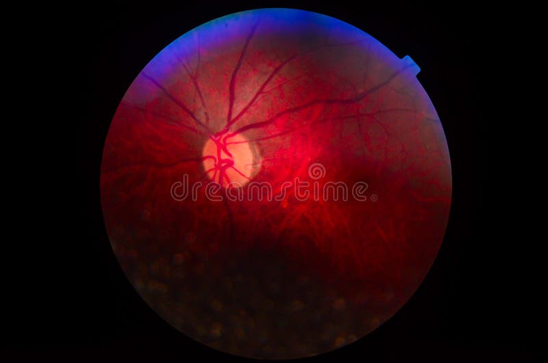 The eye of the microscope stock image. Image of medical - 85289745