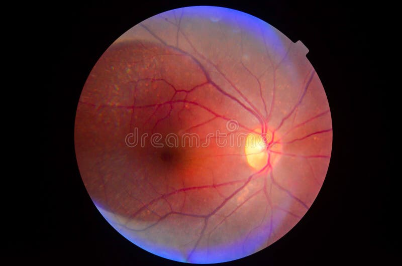 The eye of the microscope stock photo. Image of diseases - 85293584
