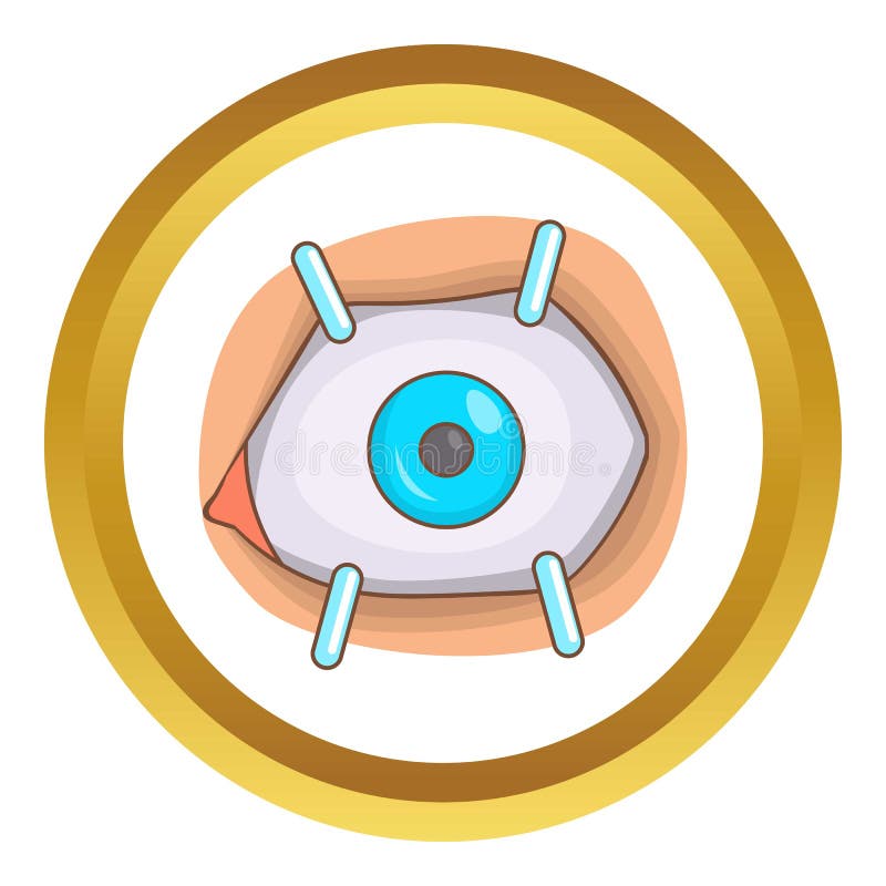 Corectomy Stock Illustrations – 9 Corectomy Stock Illustrations ...