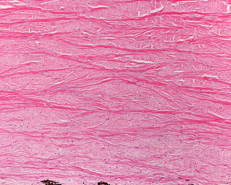 Eye Sclera. Collagen Fibers Stock Photo - Image of microscopic ...
