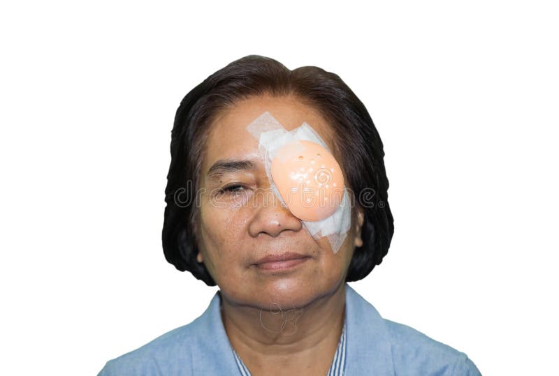 Eye shield stock image. Image of shield, face, treatment - 160570471