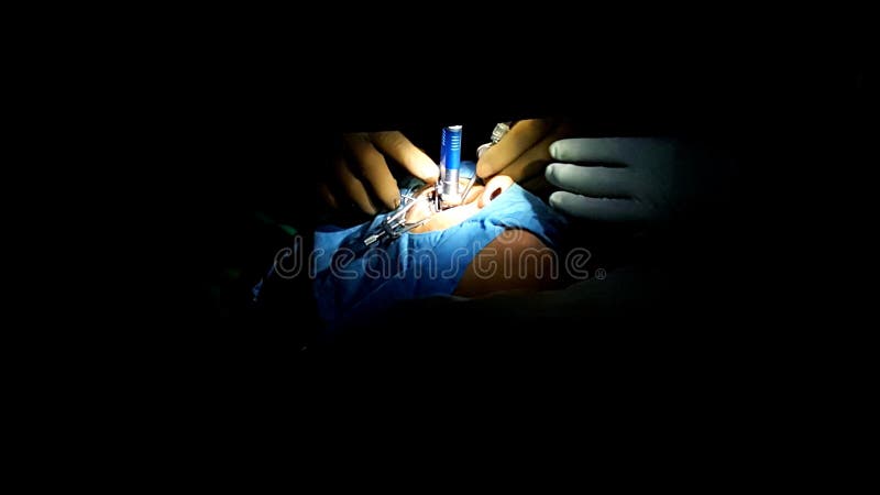 Eye Surgery in Dark Operation Theatre Stock Photo - Image of dark, view ...
