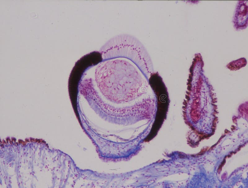 Longitudinal Section of the Stem Woody Plant Under the Microscope Stock ...