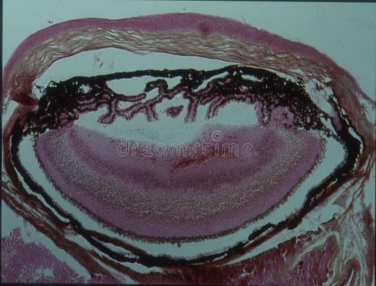 Eyeball in Longitudinal Section Stock Photo - Image of brown, optik ...