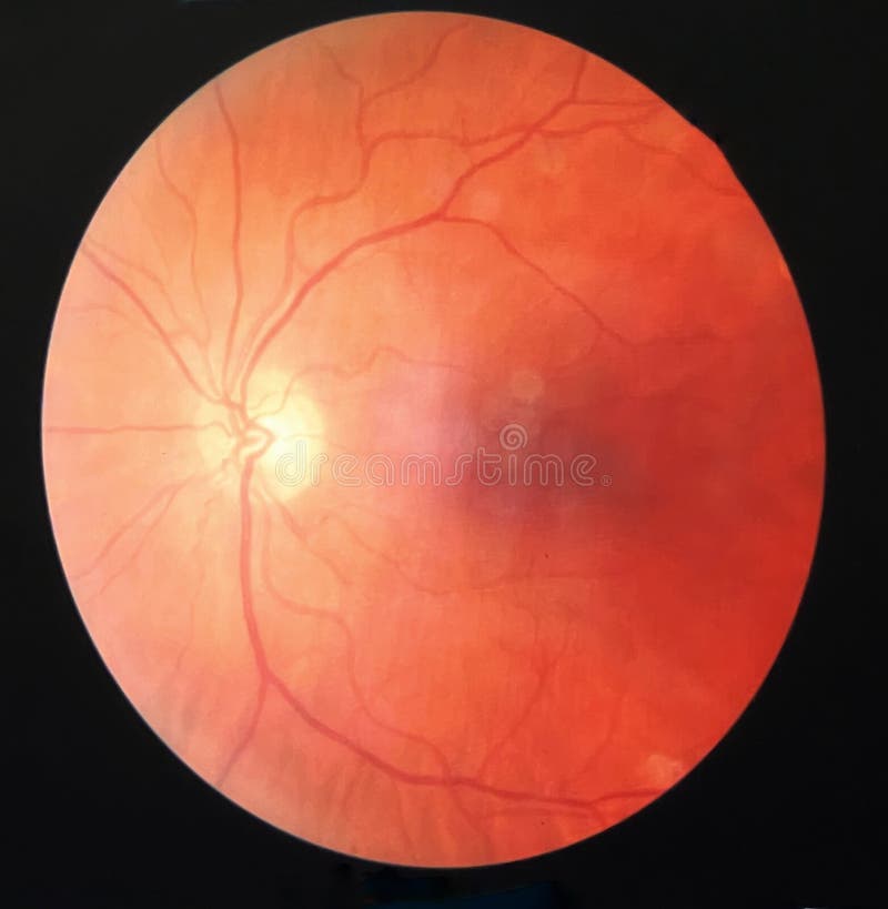 Eyeball stock image. Image of blood, viens, test, eyeball - 266055995