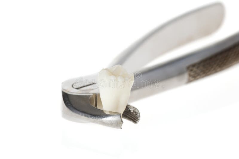 Fórceps y diente dentales foto de archivo. Imagen de oral - 21014948