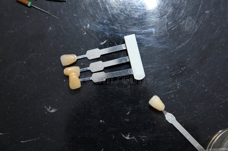 Fabrication of Dental Crowns and Dentures Made of Ceramic. Ceramic ...