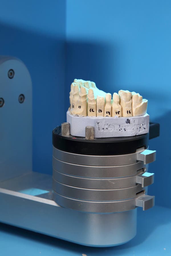 Fabrication of Dental Crowns and Dentures Made of Ceramic. Ceramic ...