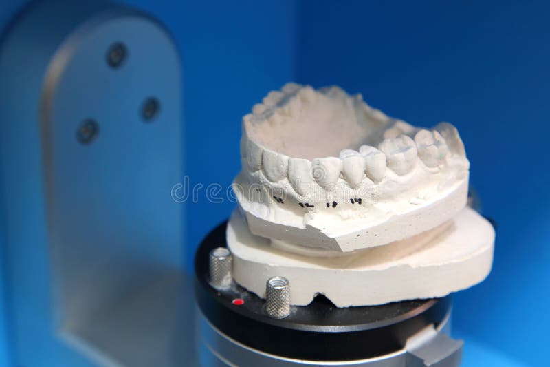 Fabrication of Dental Crowns and Dentures Made of Ceramic. Ceramic ...