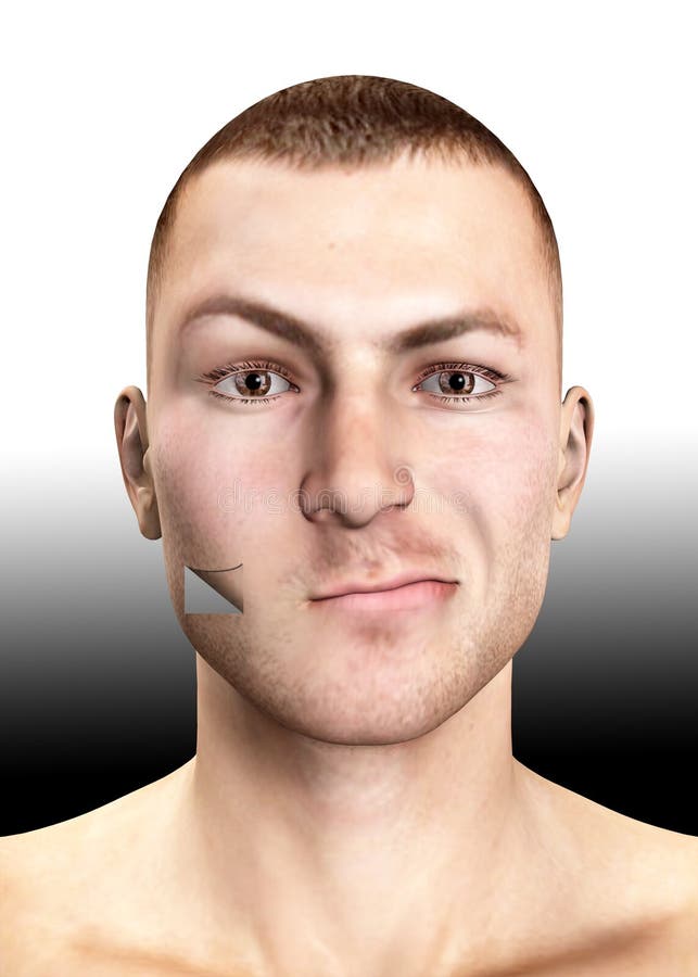 Face descascada ilustração stock. Ilustração de cara, pele - 8896787