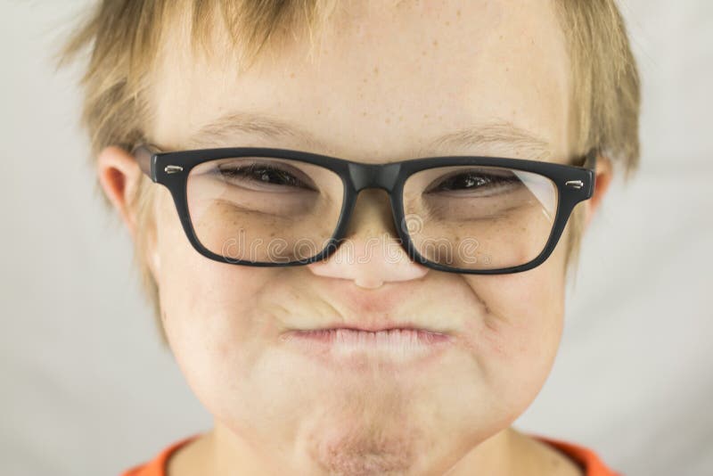 The Face of Downs Syndrome stock image. Image of challenged - 58318345