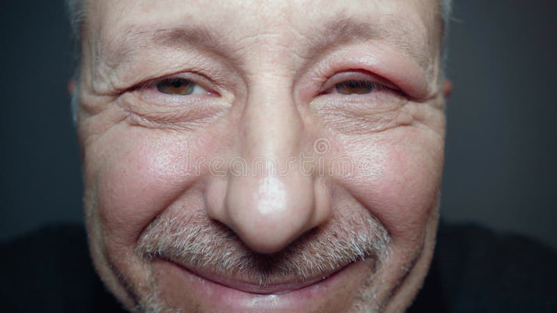 The Face of an Elderly Funny Man with a Beard Smiles. Stock Video ...