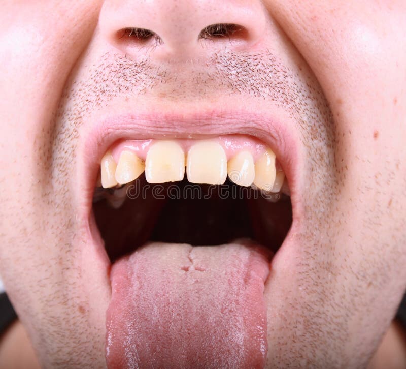 Face Feia Do Homem Assustador Foto de Stock - Imagem de facial, louco ...